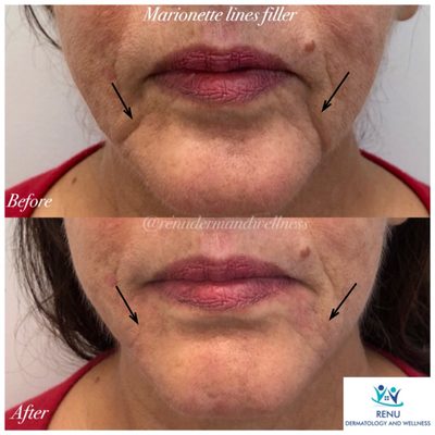 RENU DERMATOLOGY AND WELLNESS - Updated January 2026 - 144 Photos & 108 ...