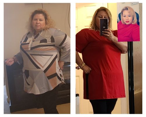 MARC M ZARE, MD, FACS - Updated January 2026 - 18 Photos & 141 Reviews ...