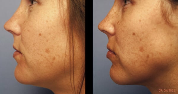 JOSEPH R BARNTHOUSE, MD - Updated May 2025 - 47 Photos - 1010 ...