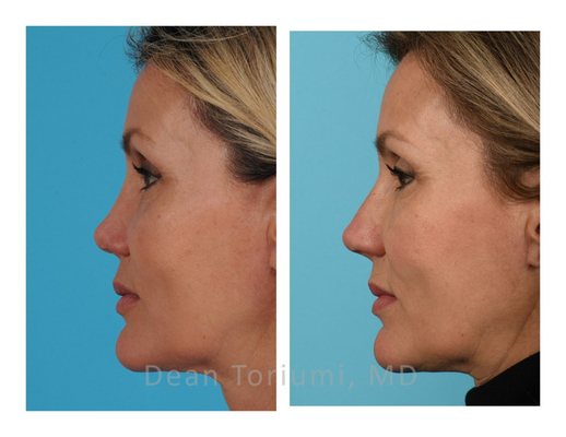 DEAN TORIUMI, MD - Updated September 2025 - 68 Photos & 48 Reviews - 60 ...