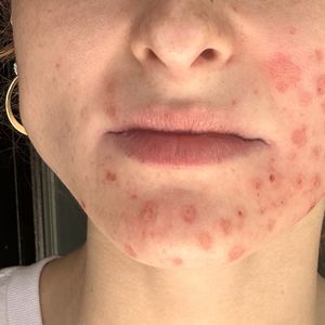 WACCAMAW DERMATOLOGY - Updated December 2025 - 64 Photos & 30 Reviews ...