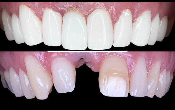 DENTAL DESIGN SMILE - Updated December 2025 - 48 Photos & 58 Reviews ...