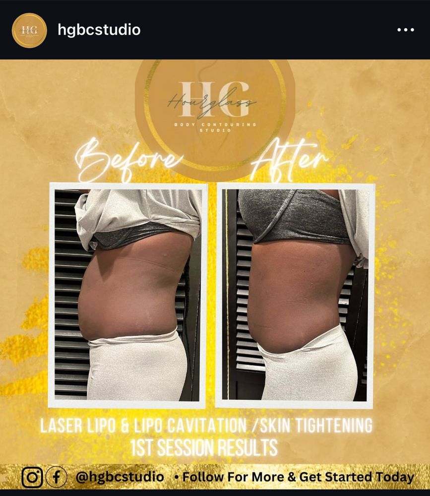 HOURGLASS BODY CONTOURING STUDIO AND WELLNESS CENTER - Updated October ...