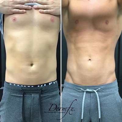 DERMFX - Updated December 2025 - 173 Photos & 288 Reviews - 3443 E ...