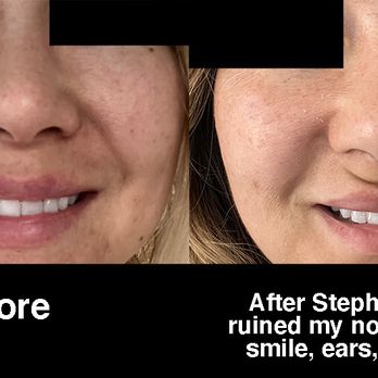 STEPHEN J PINCUS, MD, FACS - Updated May 2026 - 39 Photos & 27 Reviews ...