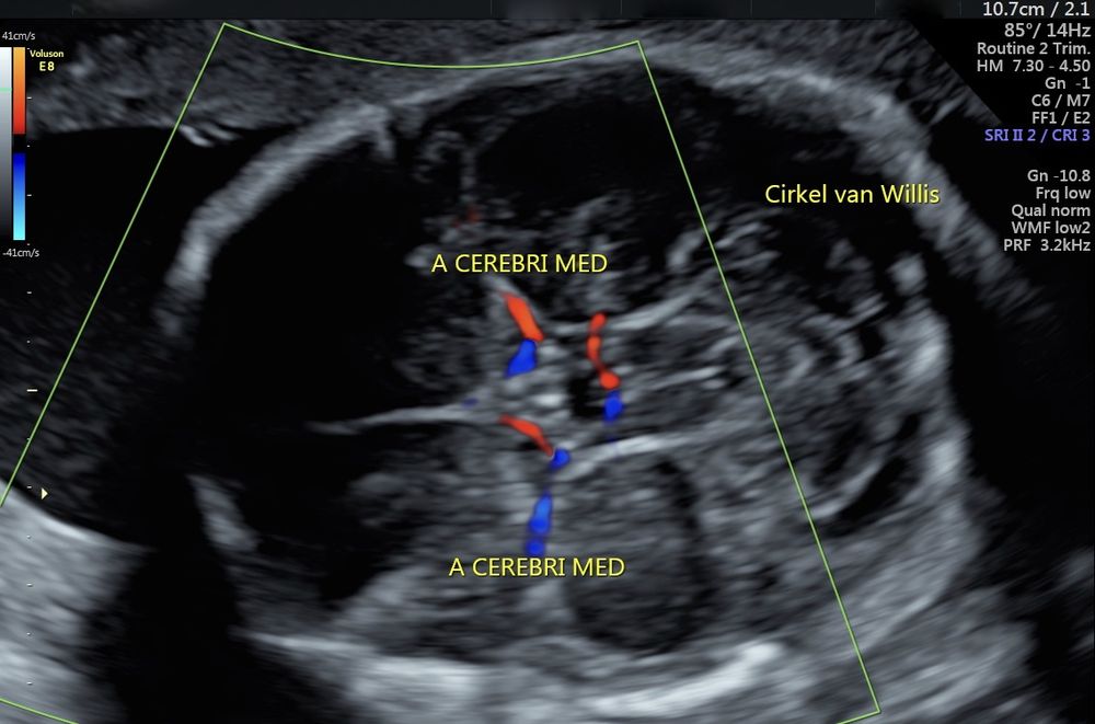 DRS PAPA ECHO AMSTERDAM - Updated March 2025 - 46 Photos - Kea ...