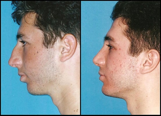 BARRY M. WEINTRAUB MD - Updated October 2025 - 64 Photos & 101 Reviews ...