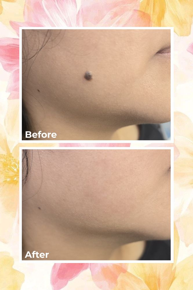 PLUSH DERMA LASER CLINIC - Updated September 2025 - 105 Photos & 114 ...