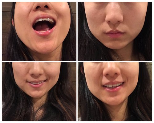 SAM MOST, MD - Updated September 2025 - 15 Photos & 97 Reviews - 801 ...