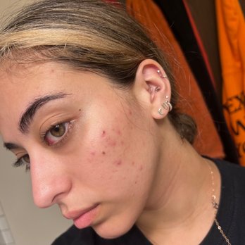 LAURA SWANSON, MD - THE POLYCLINIC - Updated January 2026 - 11 Reviews ...