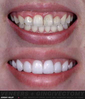 JEREMY HELDT, DDS - Updated September 2024 - 224 Photos & 98 Reviews ...