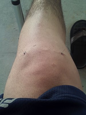 HEIGHT LENGTHENING- DR. SHAHAB MAHBOUBIAN - Updated June 2026 - 14 ...