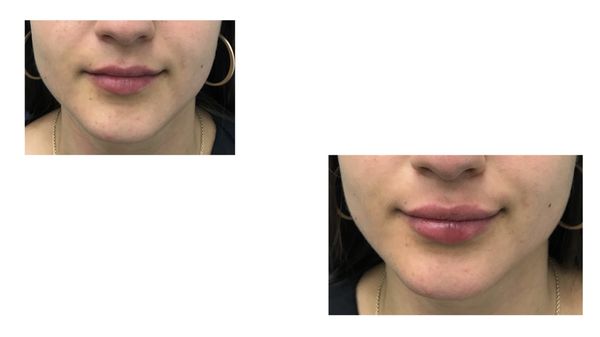 BENJAMIN P CAUGHLIN MD, FACS - Updated December 2025 - 20 Photos & 13 ...