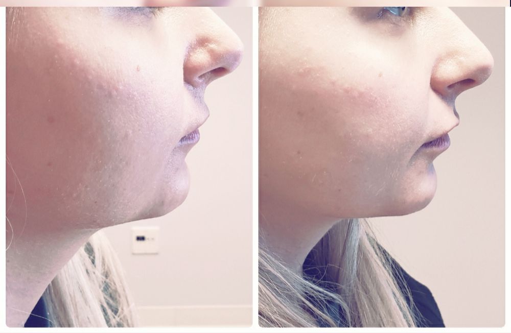 NATURELLE MED SPA - Updated August 2024 - 12 Photos - 400 W Liberty Dr ...