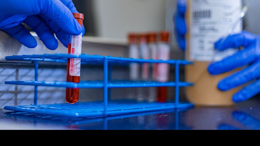 FREEDOM PLASMA - Updated December 2025 - 5651 38th Ave N, St ...