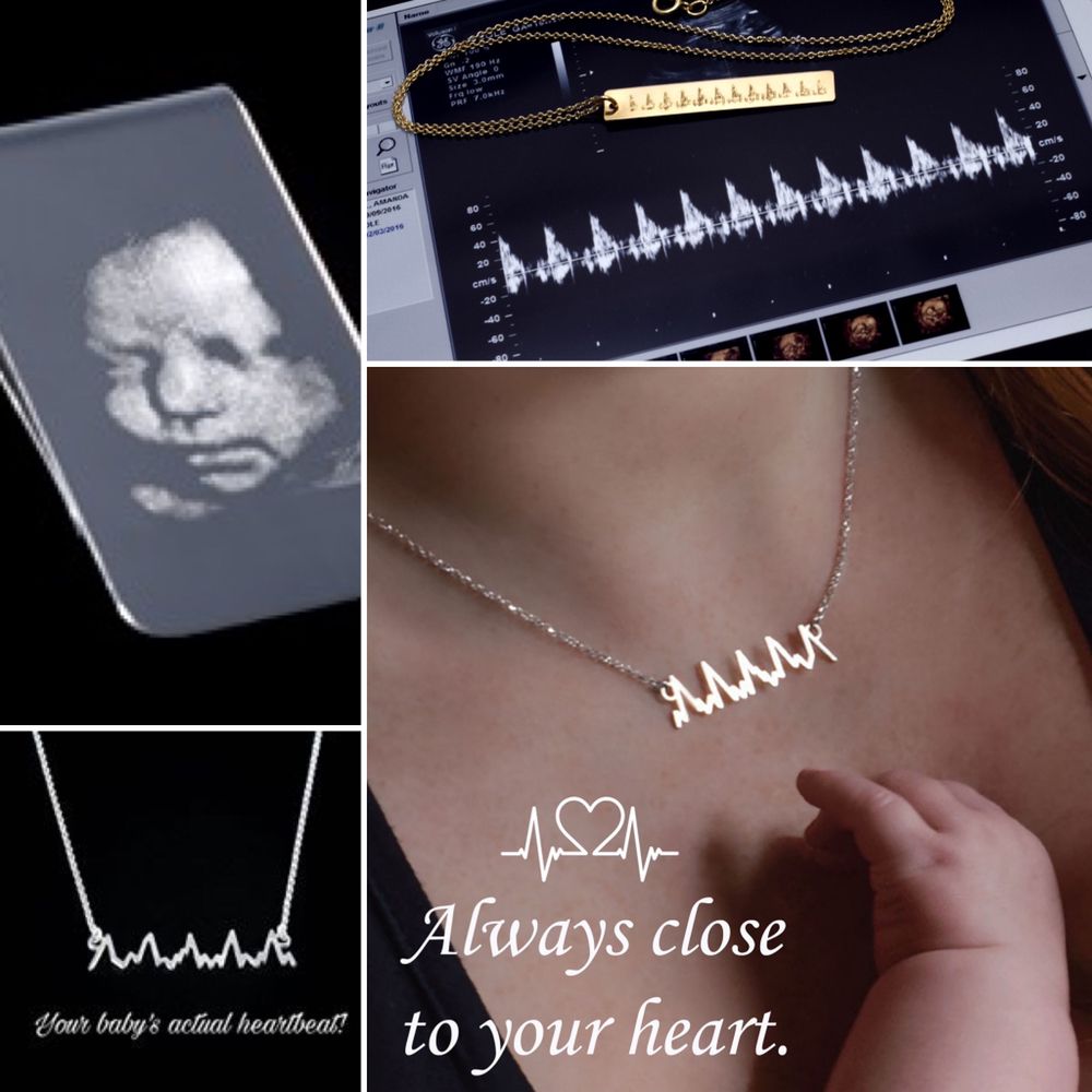 HEY BABY! 4D ULTRASOUND STUDIO - 37 Photos - 12703 Perry Hwy, Wexford ...