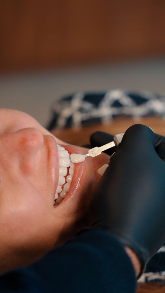 GENESIS BY DR BEN REYHANI - Updated February 2026 - 59 Photos & 28 Reviews - 8797 Beverly Blvd ...