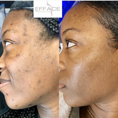 EFFACE AESTHETICS - Updated June 2024 - 127 Photos & 139 Reviews - 1111 ...