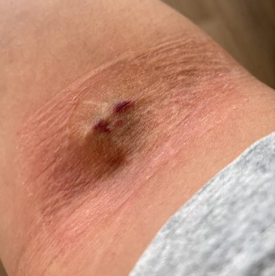 ST ELIZABETH IMAGING CENTER - Updated December 2025 - 2200 Conner Rd ...