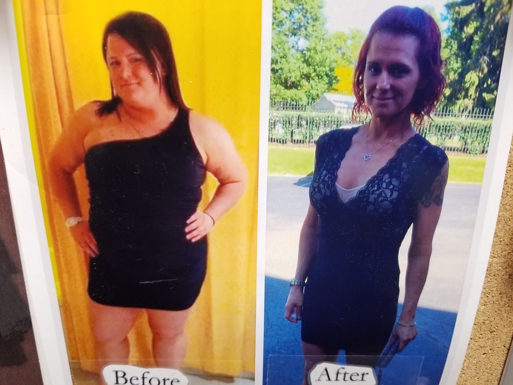 MICHAEL NUSBAUM, MD, FACS - Updated September 2025 - 95 Madison Ave ...