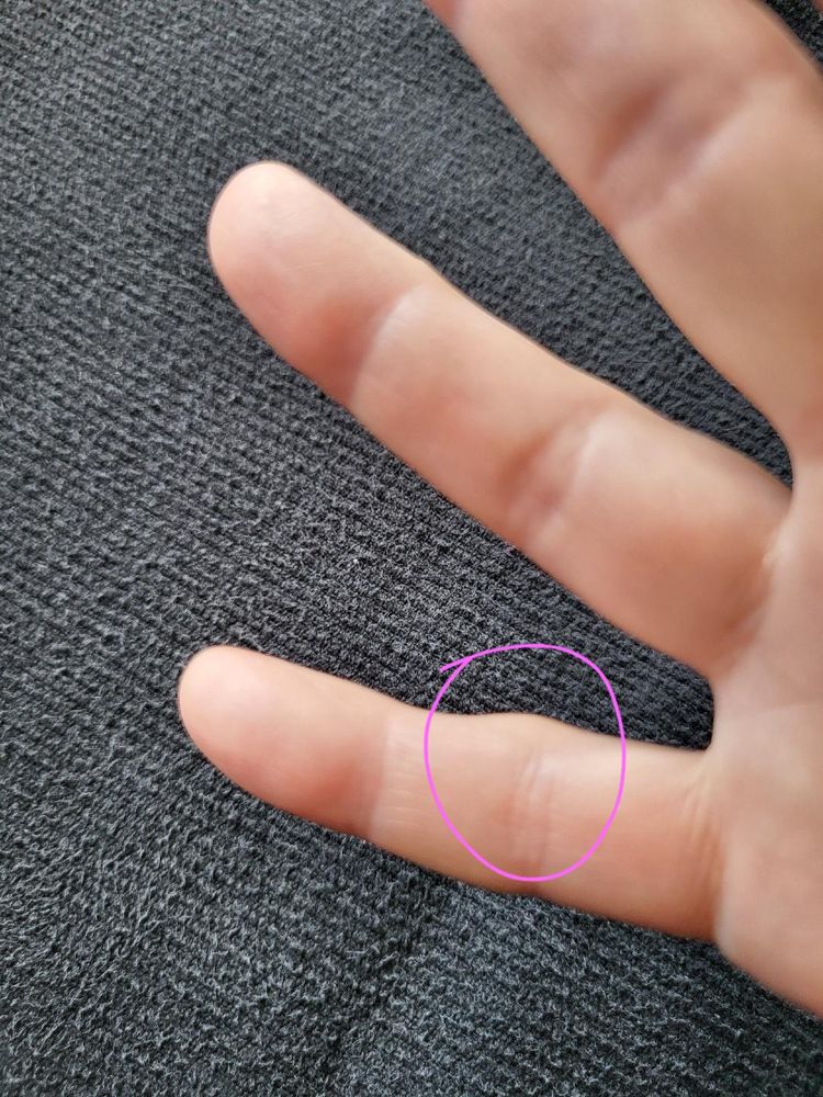 NATURAL BALANCE ACUPUNCTURE & HERBS - Updated October 2025 - 10 Photos ...