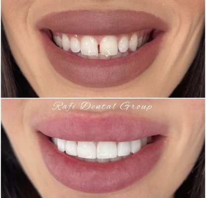 RAFI DENTAL GROUP - Updated October 2024 - 82 Photos & 167 Reviews ...