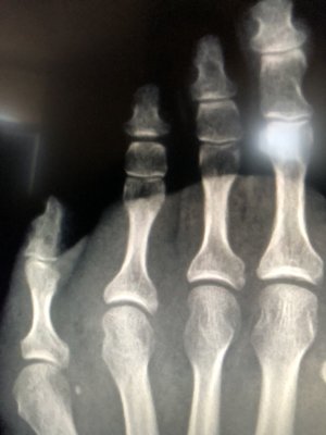 SIMMONS FOOT AND ANKLE - Updated December 2025 - 26 Reviews - 1355 S ...