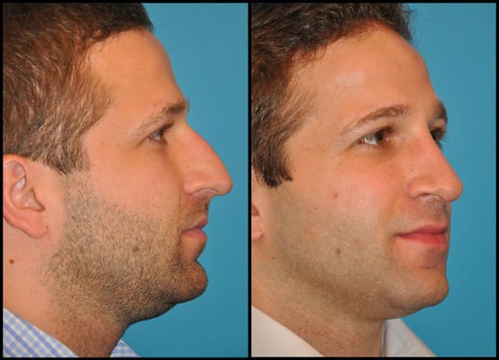 BARRY M. WEINTRAUB MD - Updated October 2025 - 64 Photos & 101 Reviews ...