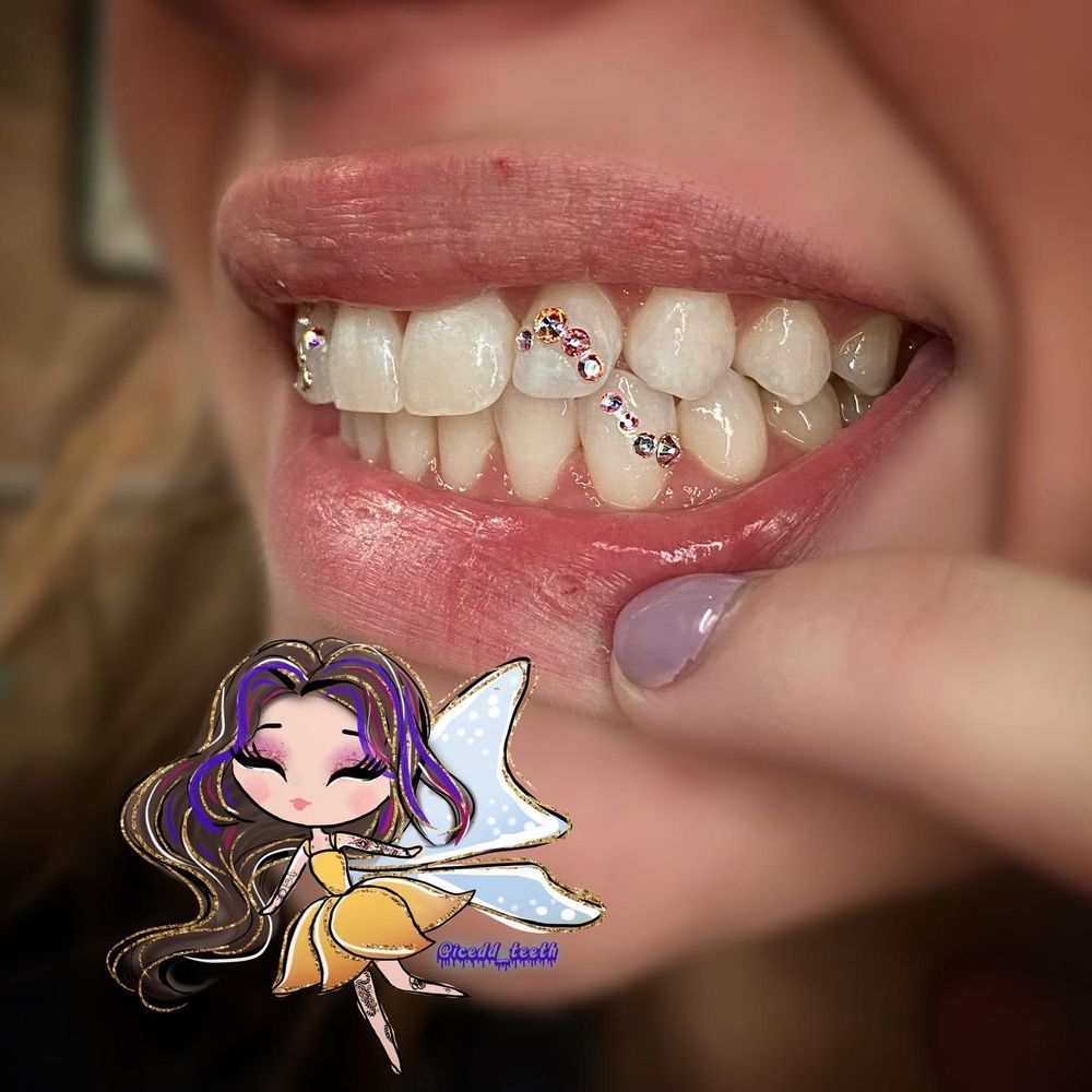 ICEDD TEETH - Updated December 2024 - 31 Photos - 1428 K Ave, Plano ...