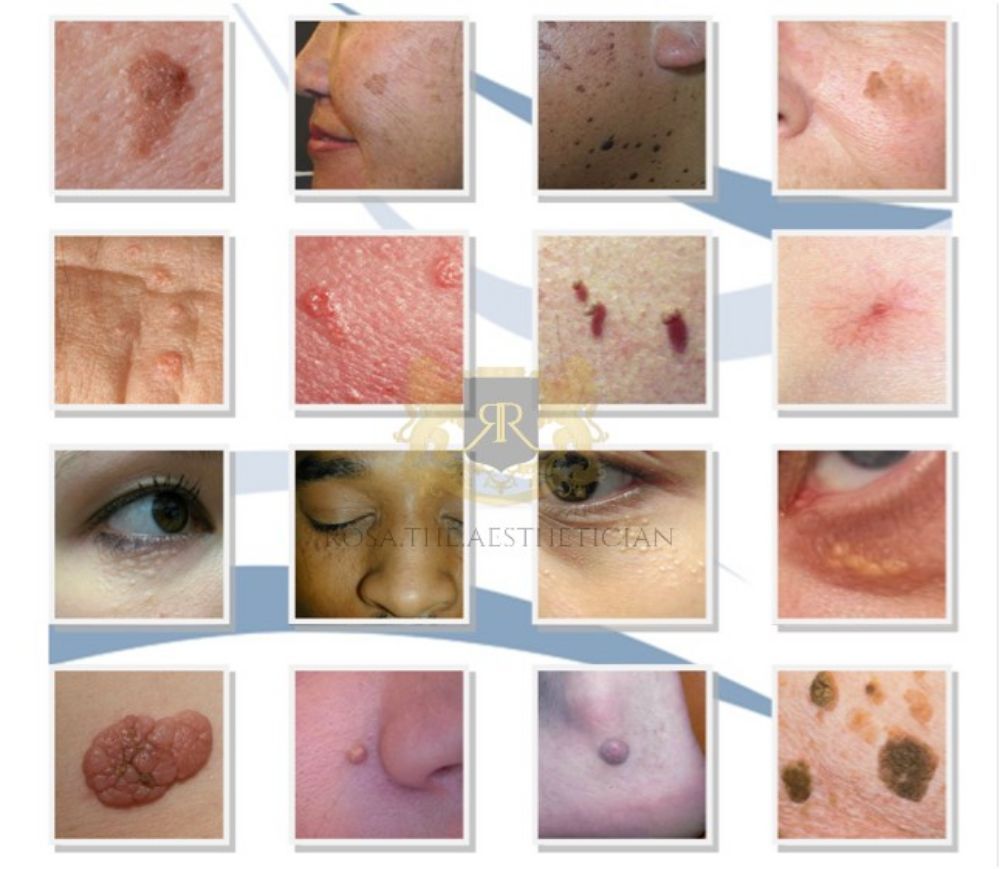 SKIN SLAYER - Updated October 2025 - 30 Photos - 4645 Avon Ln, Frisco ...