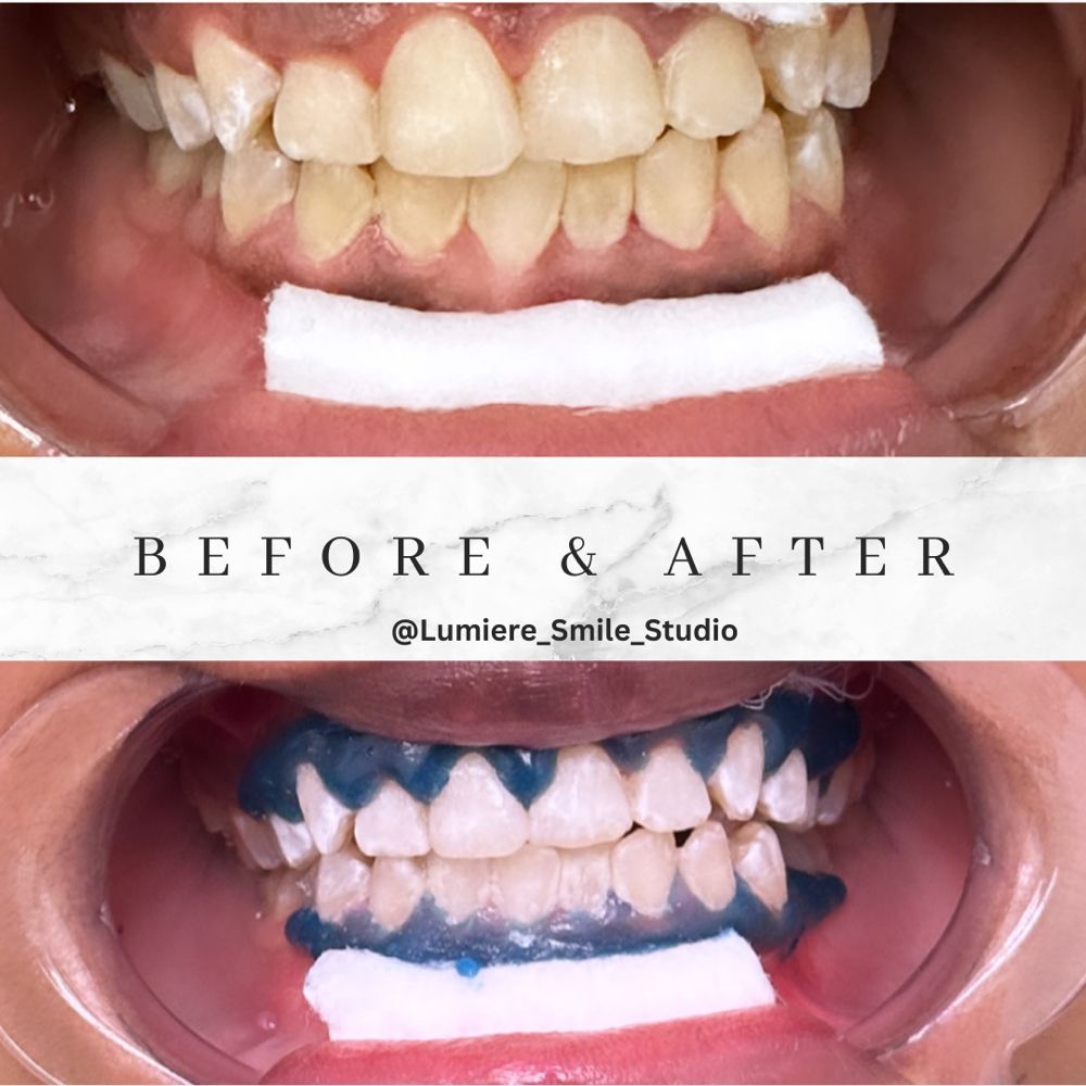 LUMIERE SMILE STUDIO - Updated September 2024 - 15 Photos - Houston ...