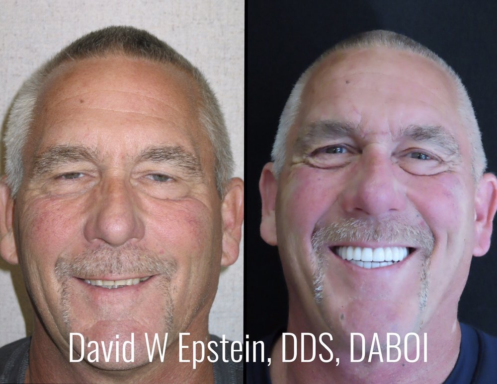 DAVID W EPSTEIN, DDS - Updated May 2024 - 70 Photos & 32 Reviews - 1701 ...