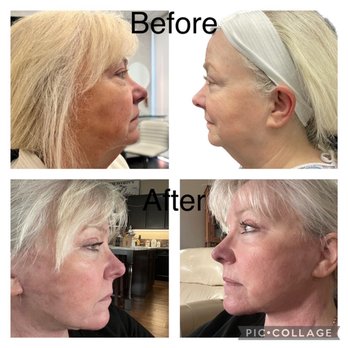 BEVERLY HILLS PLASTIC SURGERY GROUP - Updated April 2025 - 57 Photos ...