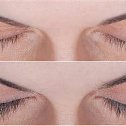 REBECCA FITZGERALD MD - 34 Photos & 163 Reviews - 321 N Larchmont Blvd ...