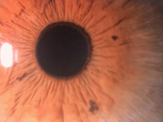 UDAY DEVGAN, MD - Updated October 2025 - 15 Photos & 160 Reviews ...