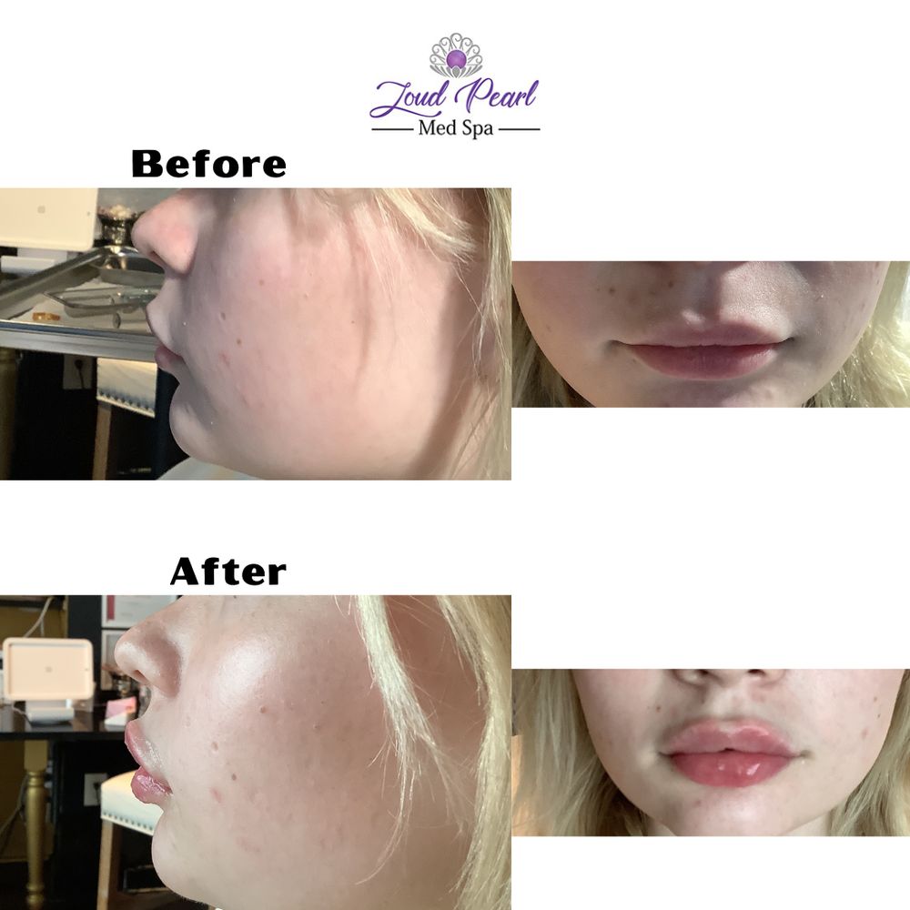 LOUD PEARL SKIN AND MED SPA - Request an Appointment - 1101 Ridge Rd ...