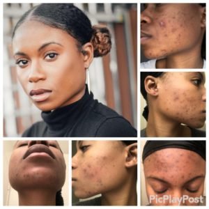 DERM BY ERICA - Updated July 2025 - 201 Photos & 97 Reviews - 4319 ...