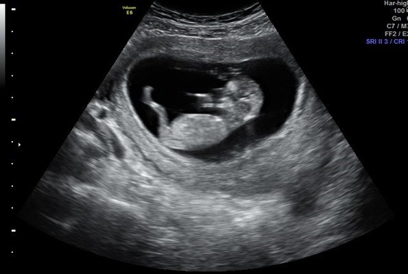 LIFE IMAGING CENTER - Updated October 2025 - 471 Mariner Blvd, Spring ...