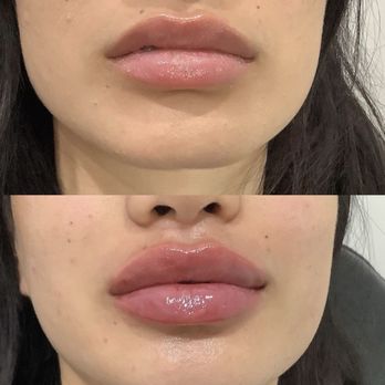 SYNERCHI MEDICAL SPA - Updated July 2025 - 98 Photos & 352 Reviews ...