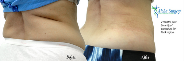 STEVEN FOWLER, MD FACS - Updated September 2025 - 14 Photos & 28 ...