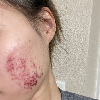 MERUM FACE BAR - Updated May 2025 - 11 Photos & 14 Reviews - 962 ...