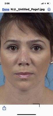 DEAN TORIUMI, MD - Updated January 2026 - 58 Photos & 49 Reviews - 60 E ...