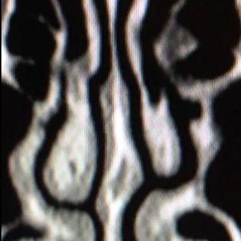 SWEDISH HOSPITAL - Updated March 2025 - 121 Photos & 402 Reviews - 5140 ...