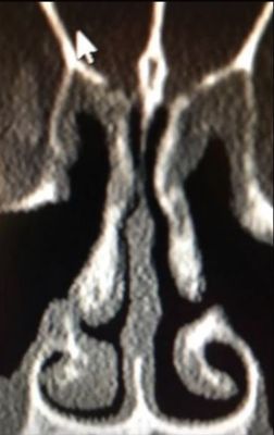 JOSEPH R RAVIV, MD - Updated October 2025 - 16 Photos & 24 Reviews ...