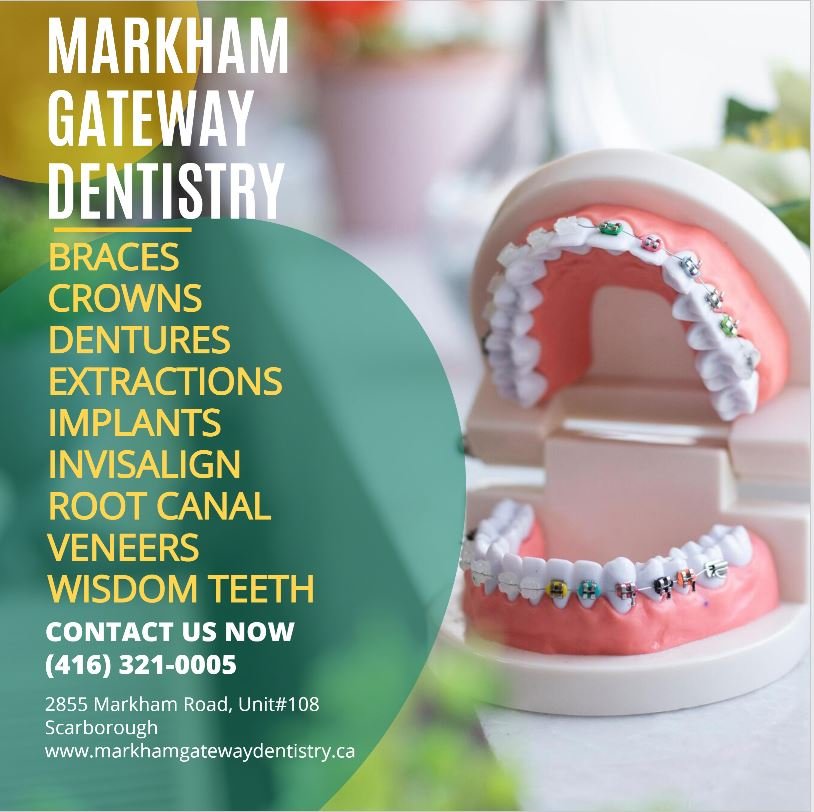MARKHAM GATEWAY DENTISTRY - Updated January 2026 - 2855 Markham Road ...