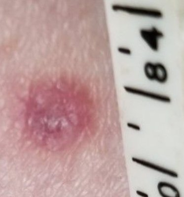 SKIN & CANCER ASSOCIATES - PLANTATION - Updated November 2025 - 26 ...