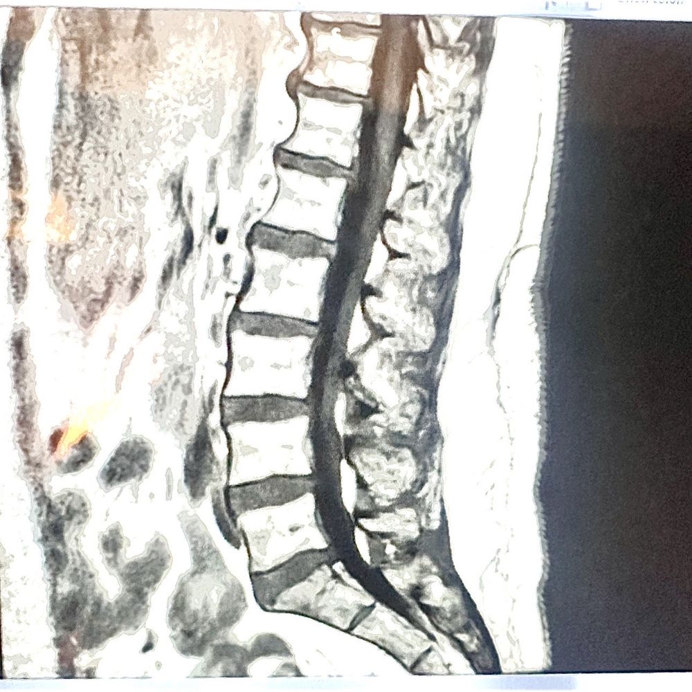 Axis Spine Center - Updated May 2026 - 20 Photos & 15 Reviews - 7600 N ...