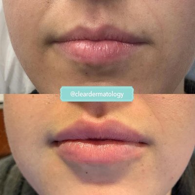 CLEAR DERMATOLOGY & AESTHETICS CENTER - Updated December 2025 - 38 ...