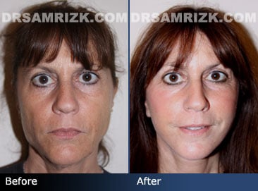 SAM RIZK, MD - Updated August 2025 - 96 Photos & 59 Reviews - 1040 Park ...