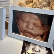 PRINCETON RADIOLOGY - Updated July 2025 - 25 Reviews - 9 Centre Dr ...